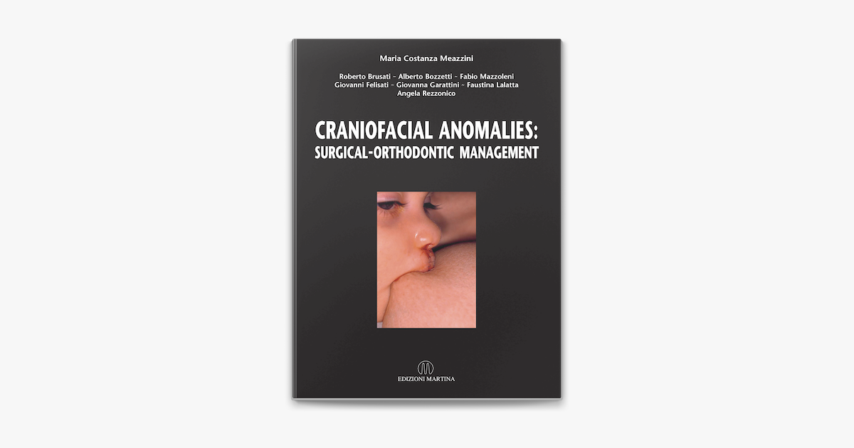 ‎craniofacial Anomalies On Apple Books