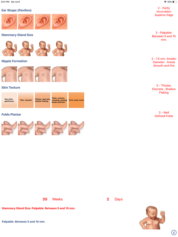 App Shopper: Neonatology: Test Capurro (Medical)
