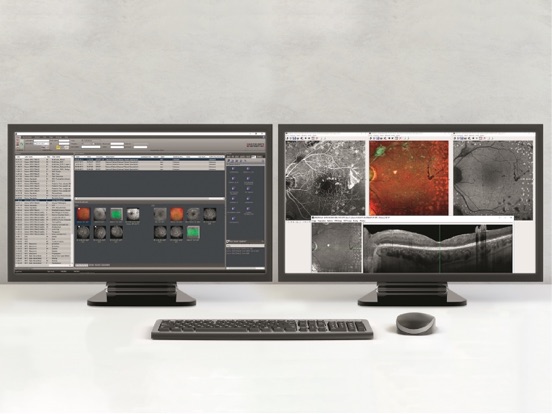 HEYEX 2 | Apps | 148Apps