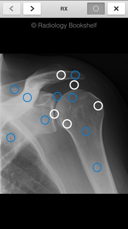 Radiology Bookshelf: Apparato Muscoloscheletrico by Inrete srl