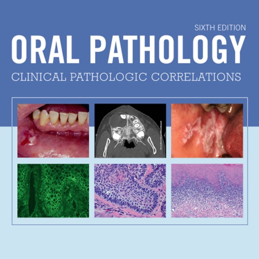 Oral Pathology, 6th Edition by Indextra AB