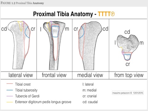 TTTT - Tibial Tuberosity Transposition Tool and Technique by Massimo ...