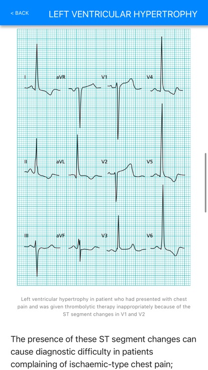 ECG Basics Pro - ECG Made Easy by Sree Hari Reddy Gadekallu ECG Basics Pro - ECG Made Easy by Sree Hari Reddy Gadekallu