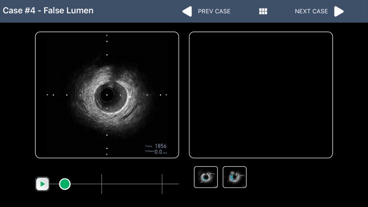 IVUS + Physiology Pro by Boston Scientific
