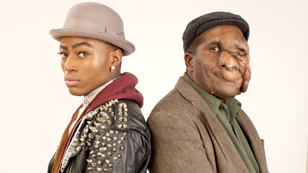 Beauty & the Beast: The Ugly Face of Prejudice | Apple TV